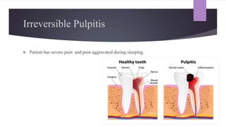 tips and tricks in root canal new 1.pptx