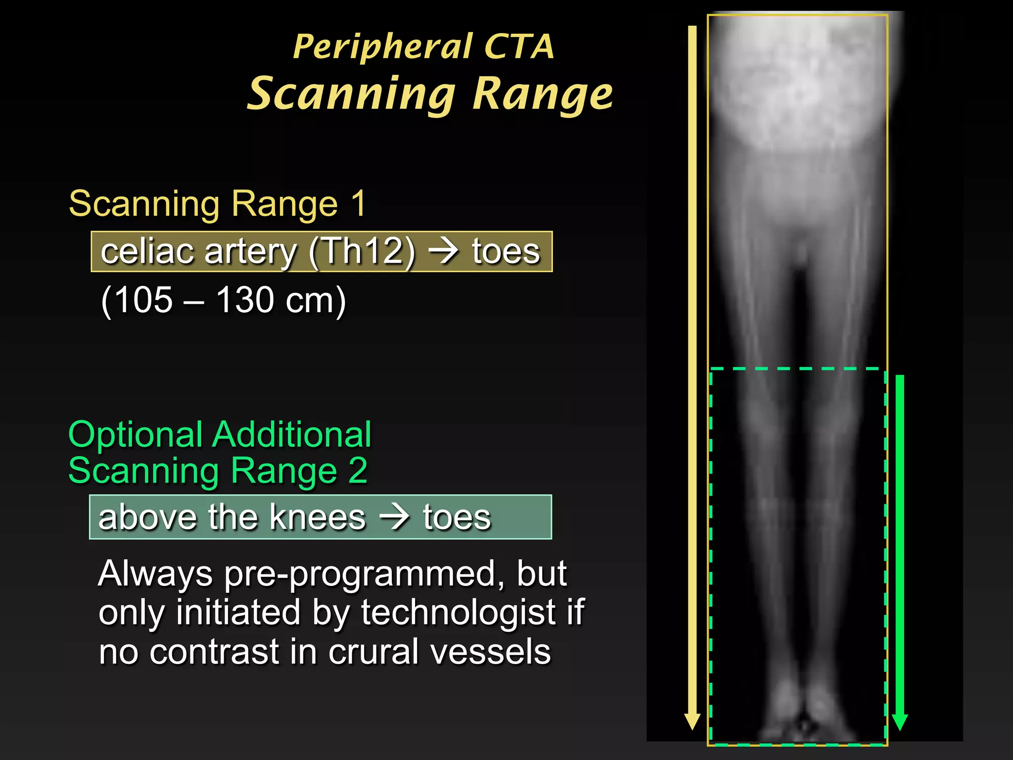 Tips and Tricks in Vascular Imaging (Lower Extremity CTA) | PDF