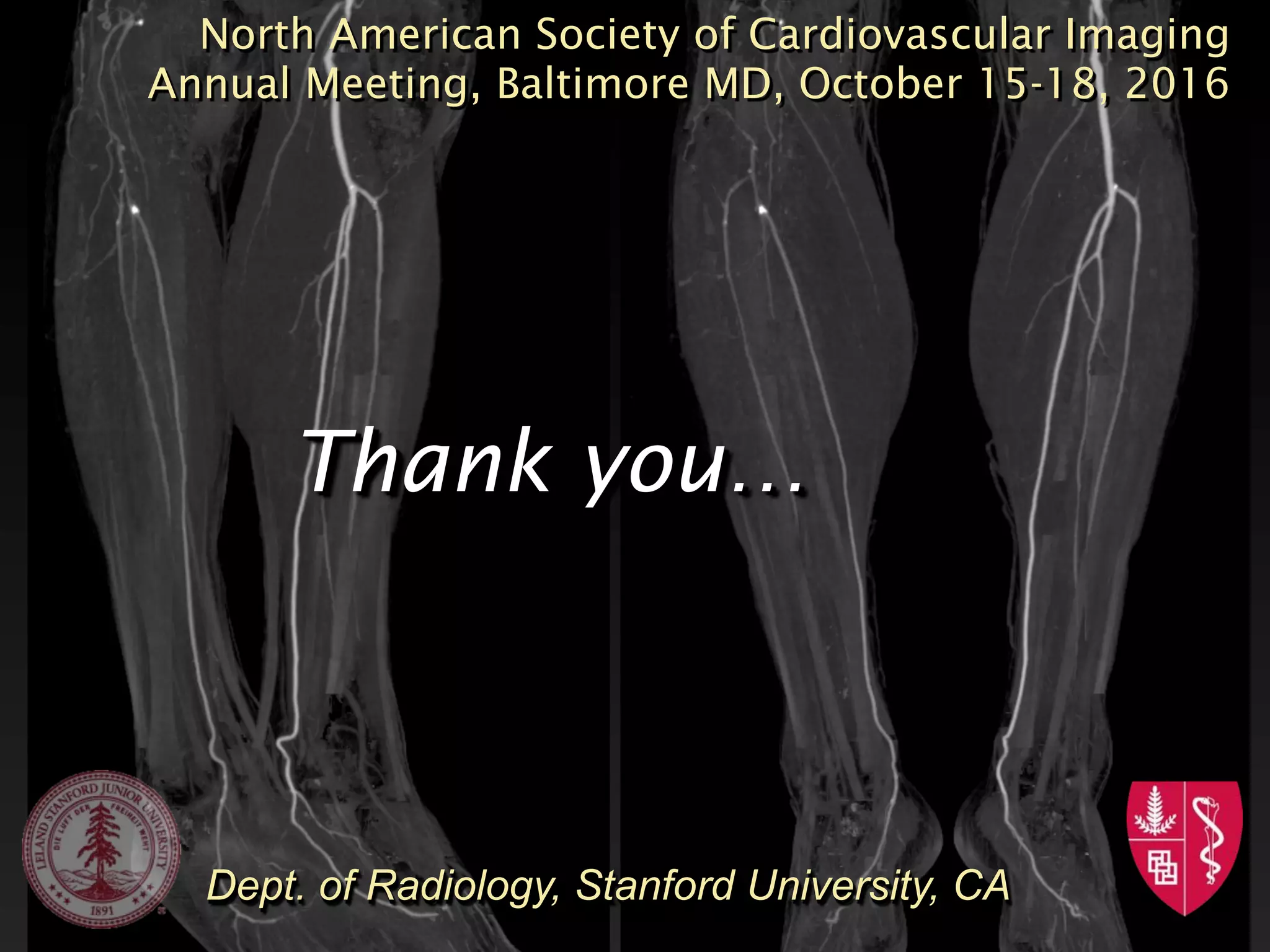 Tips and Tricks in Vascular Imaging (Lower Extremity CTA) | PPT