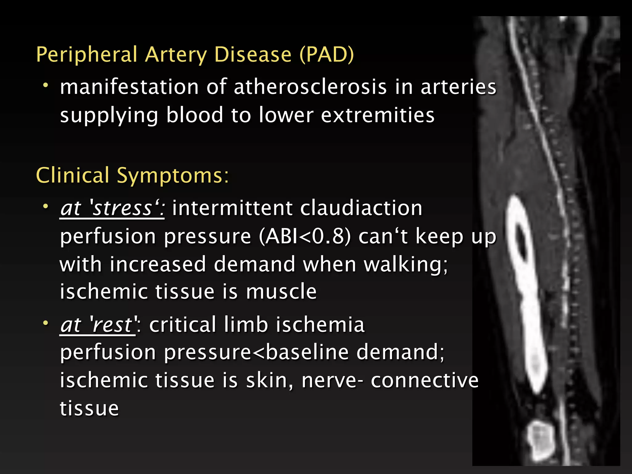 Tips and Tricks in Vascular Imaging (Lower Extremity CTA) | PDF