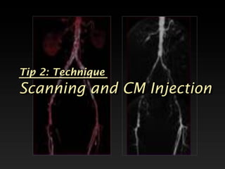Tips and Tricks in Vascular Imaging (Lower Extremity CTA) | PPT