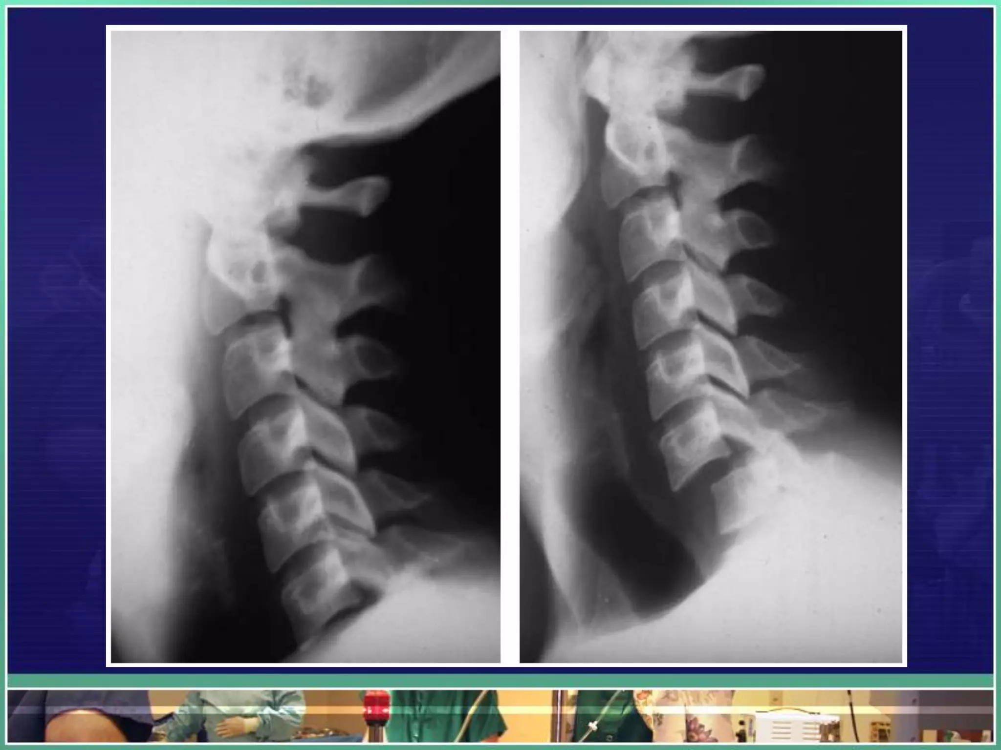Tips for interpreting x ray in trauma | PDF