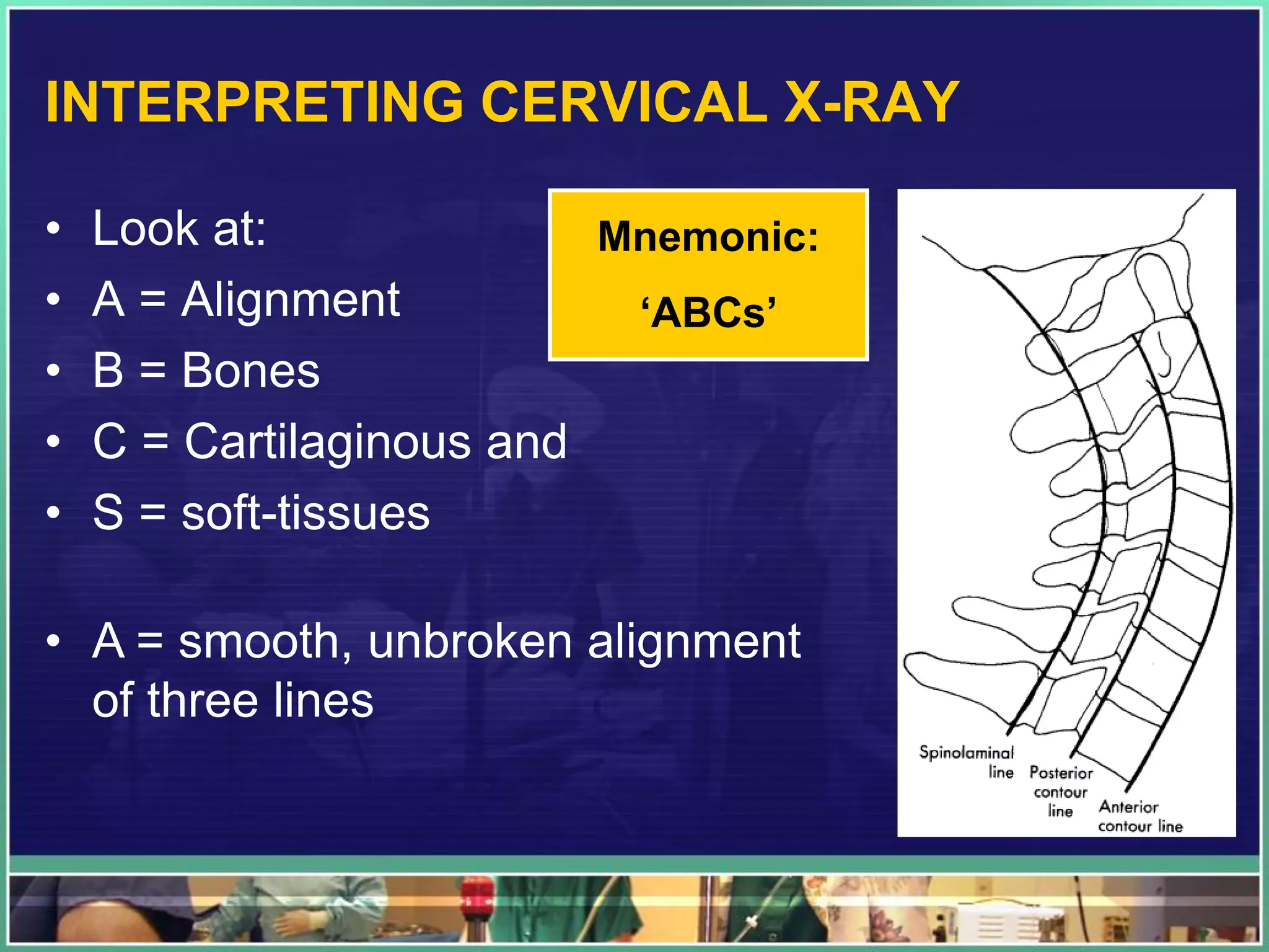 Tips for interpreting x ray in trauma | PDF