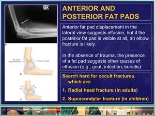 Tips for interpreting x ray in trauma | PPT