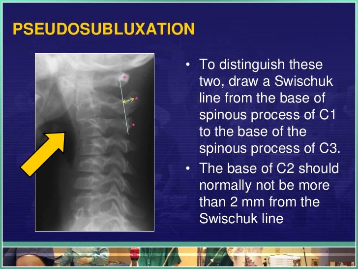 Tips for interpreting x ray in trauma
