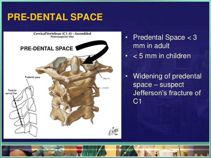 Tips for interpreting x ray in trauma