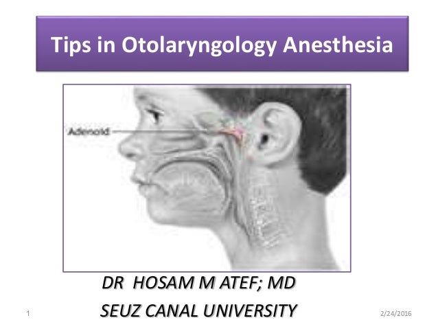 Tips in otolaryngology anesthesia | PPT