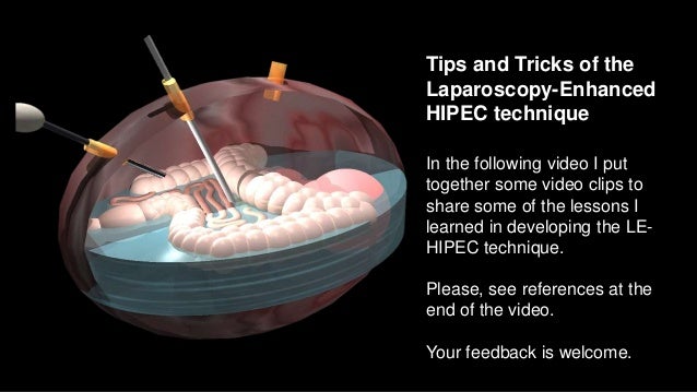Tips of the Laparoscopy-Enhanced HIPEC technique