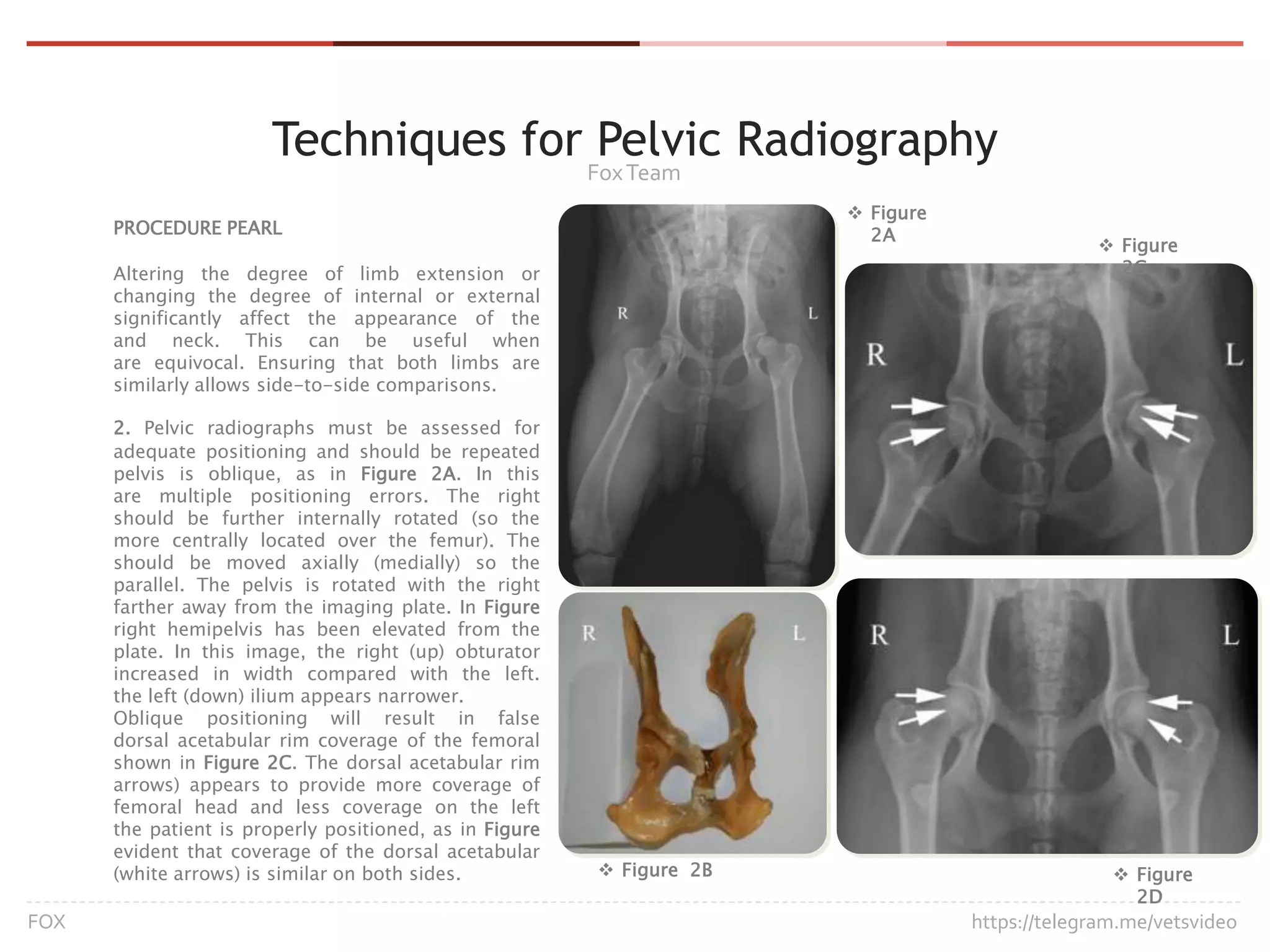 Techniques for Pelvic Radiography - Mostafa Qalavand | PPTX