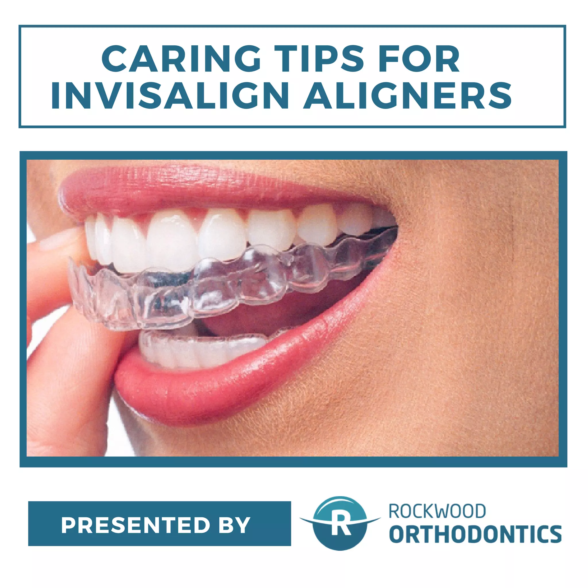 Tips to Improve Your Teeth Alignment | PDF