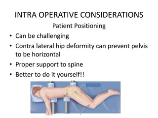 Tips & tricks of Total Hip arthroplasty in ankylosing spondylitis | PPTX