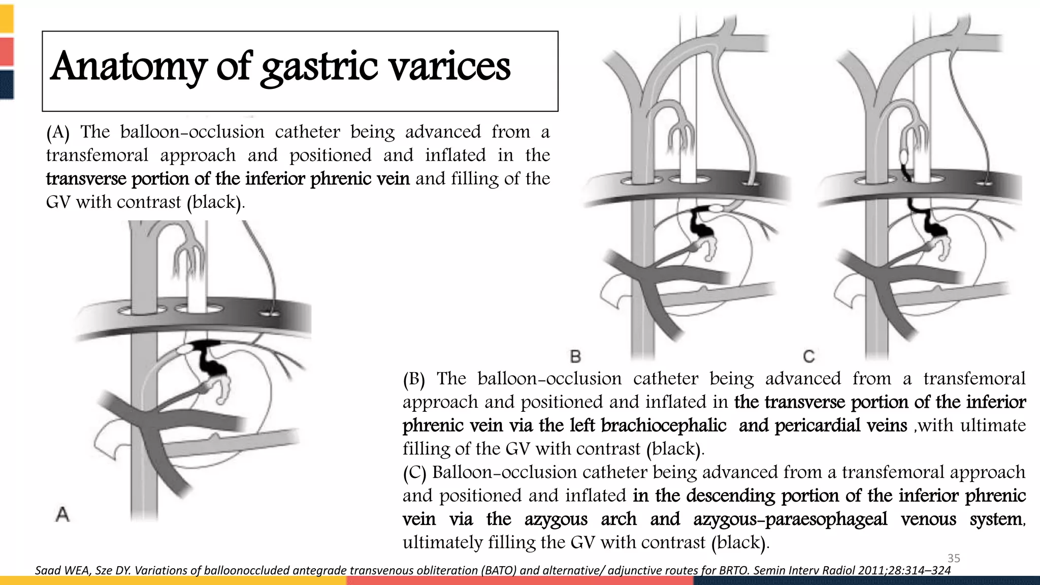 TIPS VS BRTO | PPTX | Infectious Diseases | Diseases and Conditions
