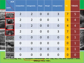 TIRADs ACR 2017, Dr Kieu Trang- Dr Quynh Anh- Dr Binh Minh | PPTX