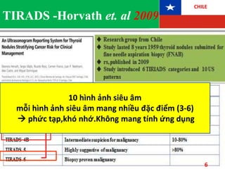 TIRADs ACR 2017, Dr Kieu Trang- Dr Quynh Anh- Dr Binh Minh | PPTX