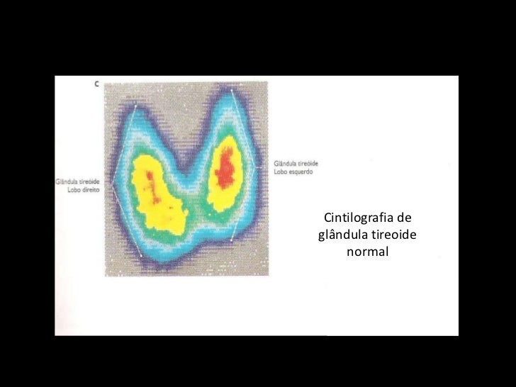 Modelo De Anatomia Da Glandula Tireoide Histologia 2