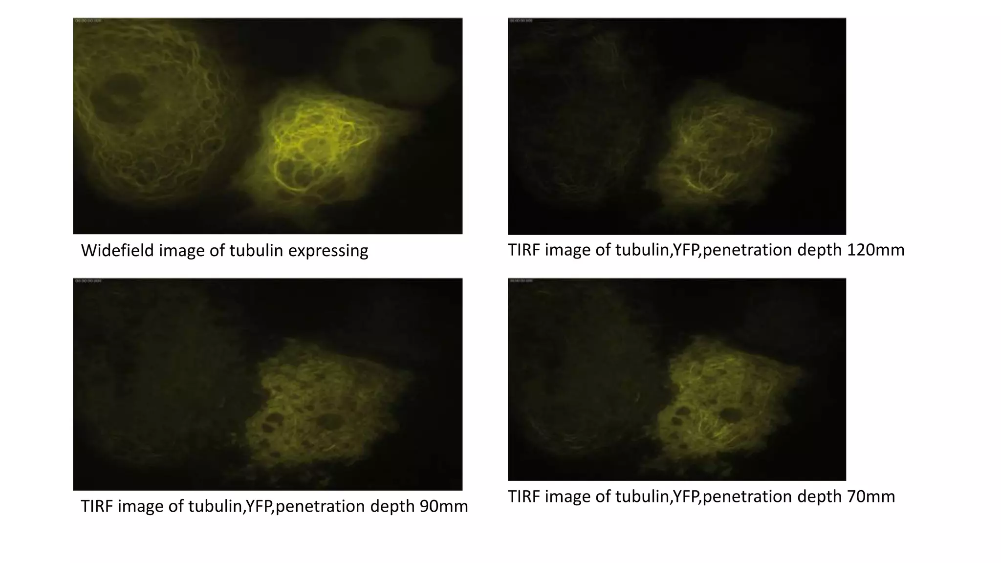 TIRF MICROSCOPE | PPTX