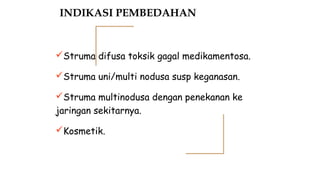 Total Thyroidectomi (Optek) | PPT