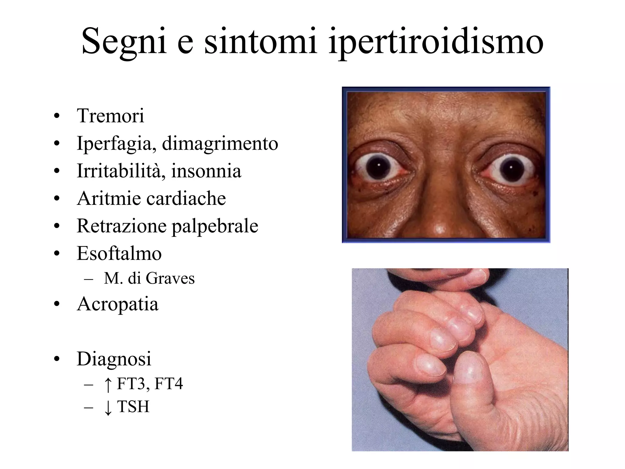 Tiroide ipotiroidismo e ipertiroidismo[1] | PDF