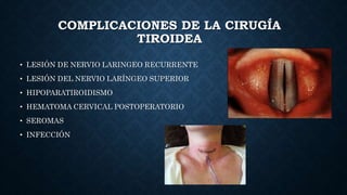 tiroidectomia cirugia general y quirurgica | PPTX