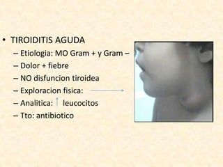 Patología tiroidea | PPTX