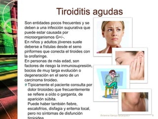 Tiroiditis | PPTX