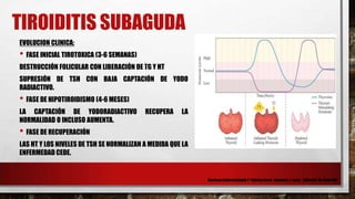 Tiroiditis Aguda, Subaguda, Silente, Hashimoto | PPTX