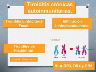 Tiroiditis | PPTX