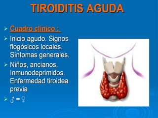 Tiroiditis | PPT