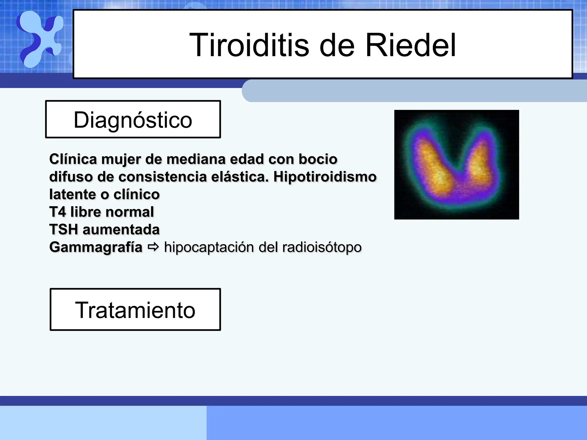 Tiroiditis. Patologías inflamatorias de la Glándula Tiroides.ppt