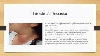 TIROIDITIS: La inflamación de la tiroides puede deberse a muchos ...