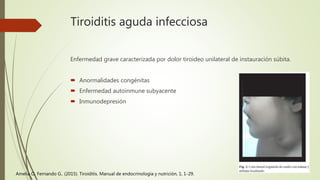 Tiroiditis | PPTX