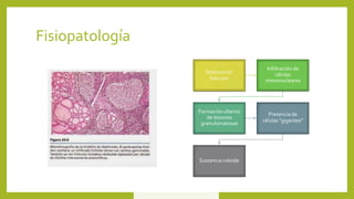 TIROIDITIS GRUPO A.pptx