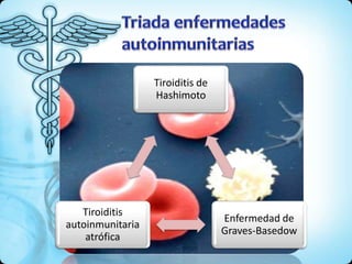 Tiroiditis Hashimoto y Riedel | PPTX