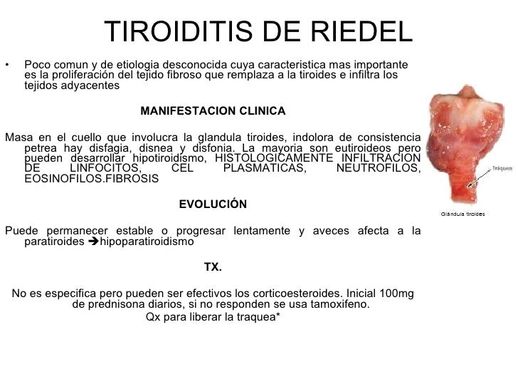 Tiroiditis