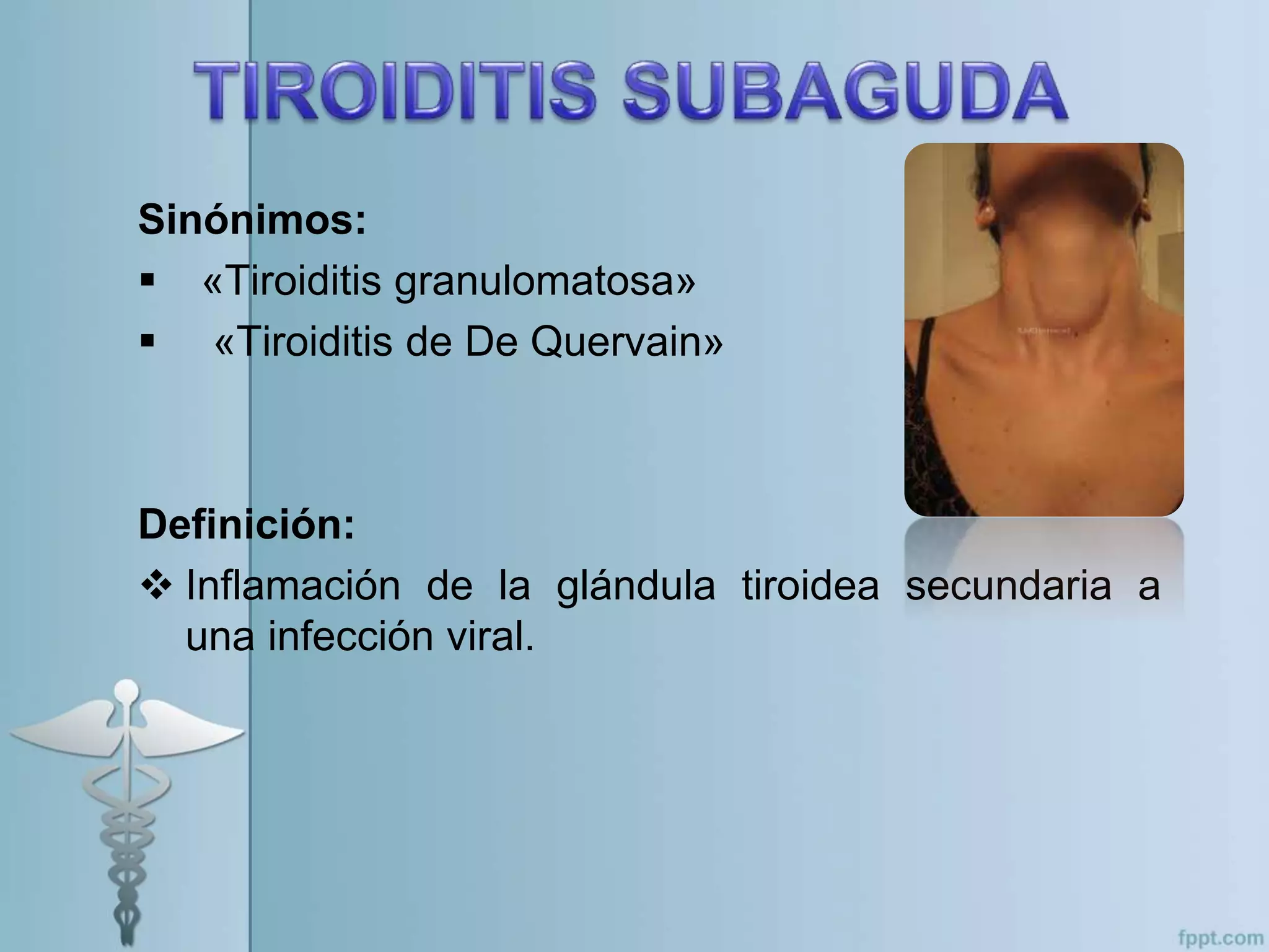 Tiroiditis subaguda - Samaria Huamanchumo Sandoval | PPT