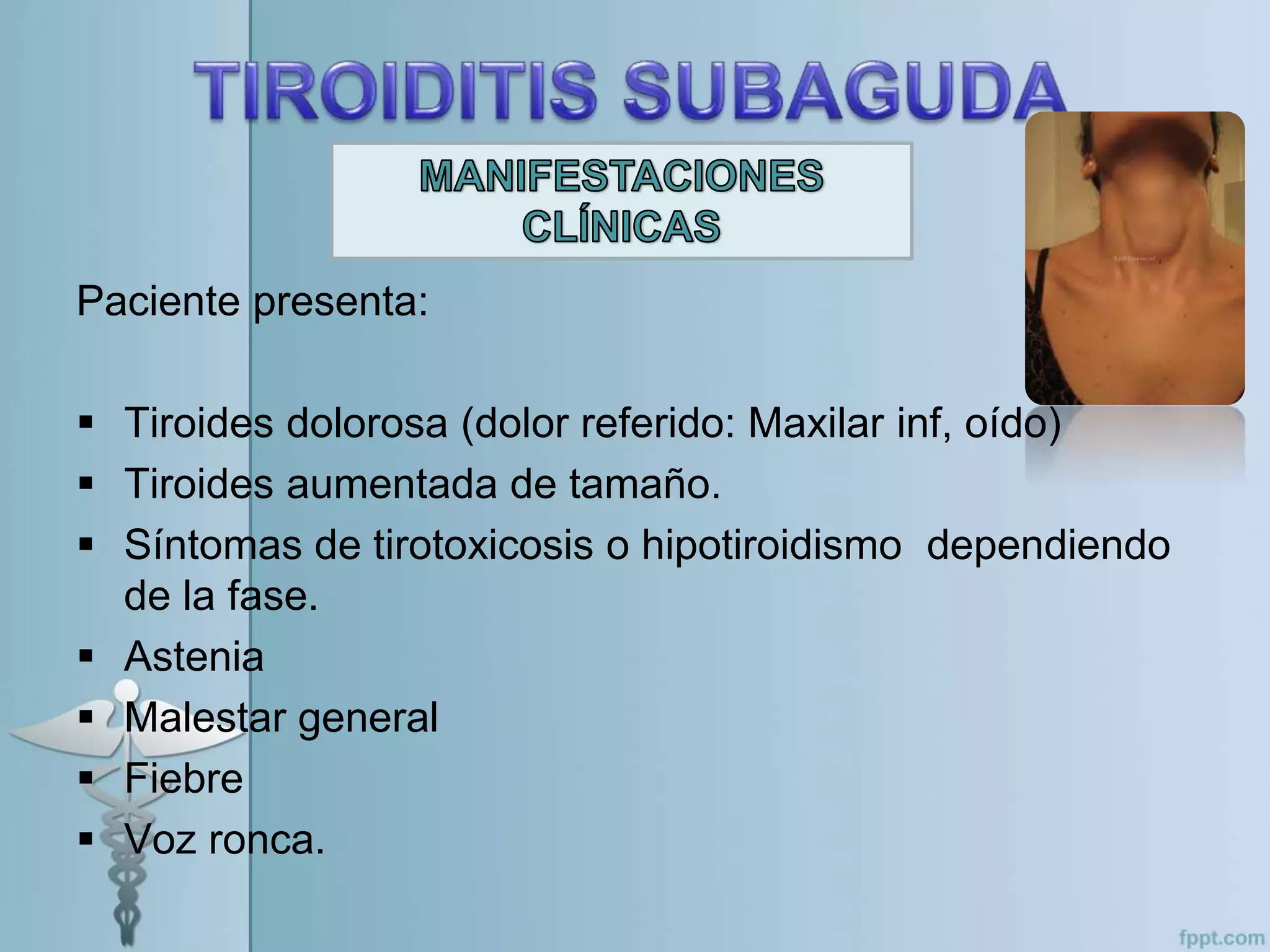 Tiroiditis subaguda - Samaria Huamanchumo Sandoval | PPT