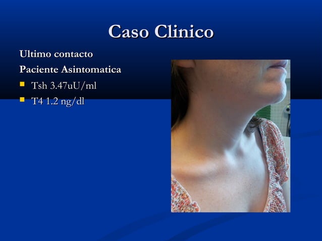 Tiroiditis subaguda | PPT