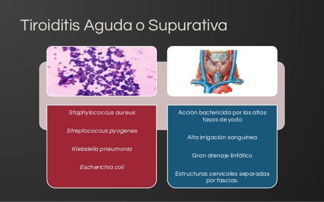 Tiroiditis y su estudio por ultrasonido