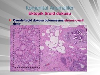 Tiroid (fazlası için www.tipfakultesi.org ) | PPT