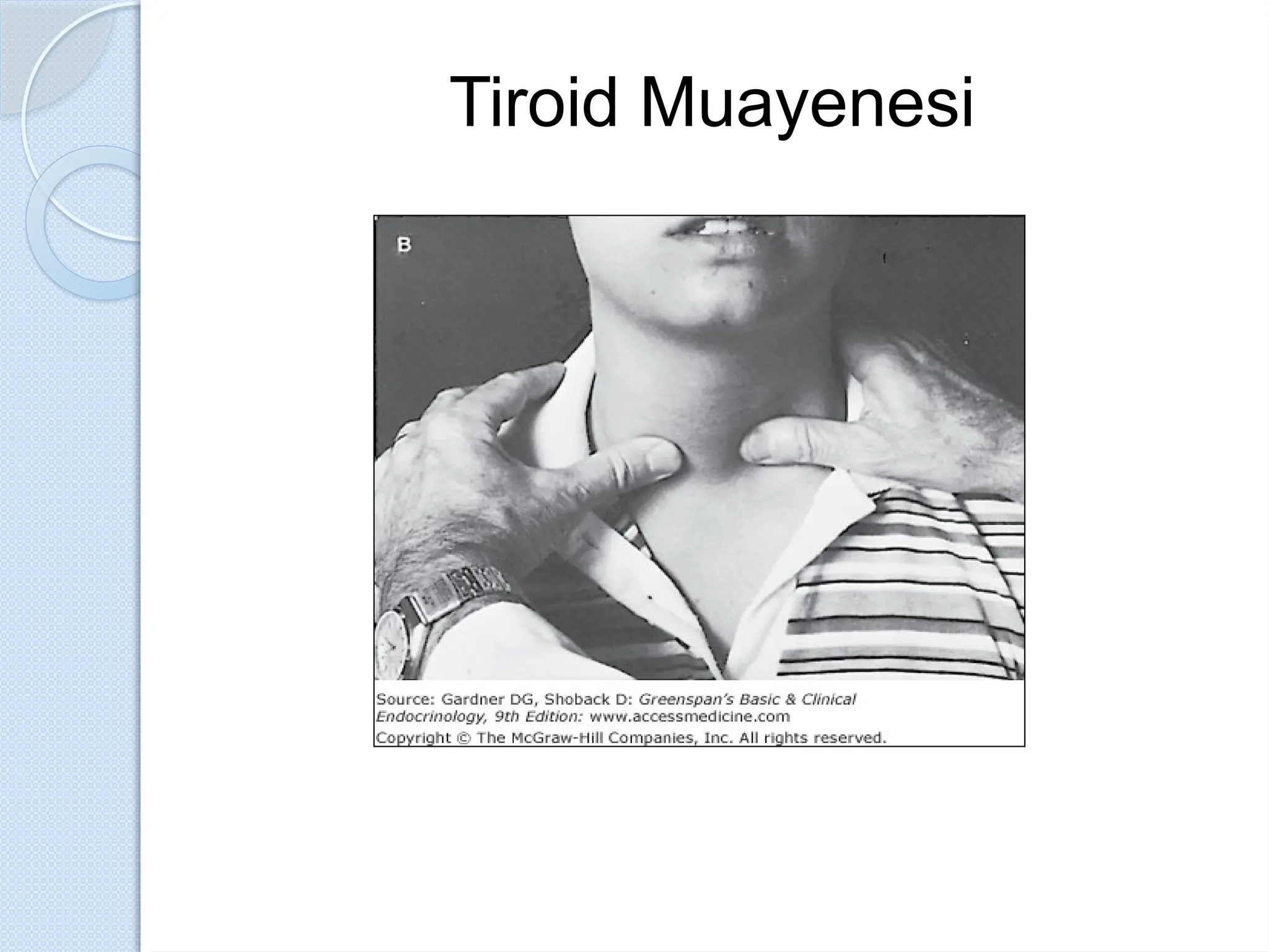 tiroid bezi hastalıkları ve boyun muayenesi.pptx