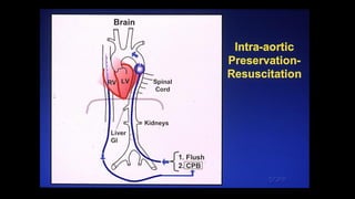 Exsanguinating trauma - from CPR to EPR | PDF