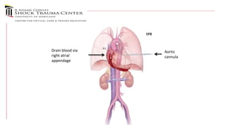 Exsanguinating trauma - from CPR to EPR | PDF