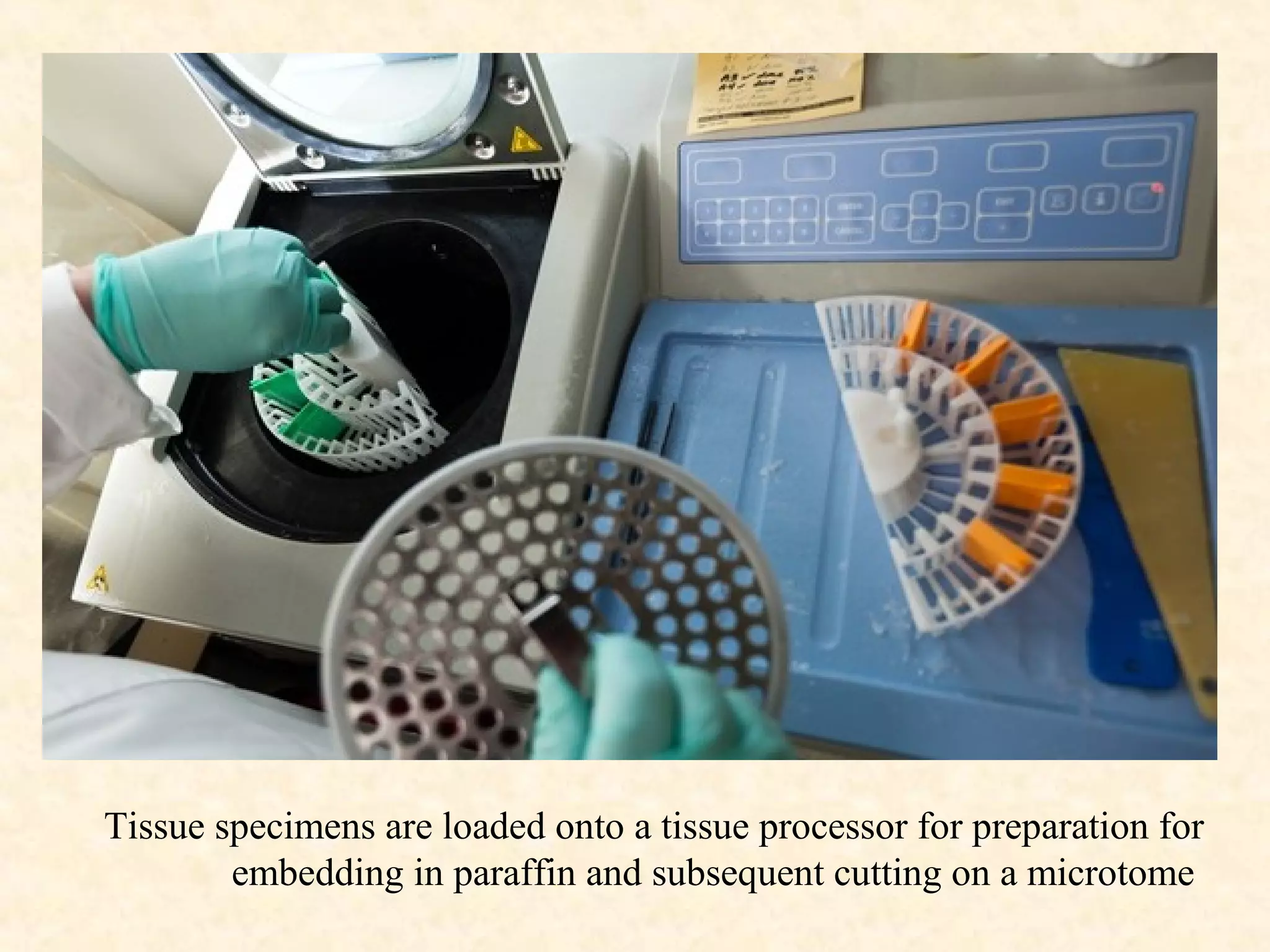 Tissue Processing in Histopathology | PPT