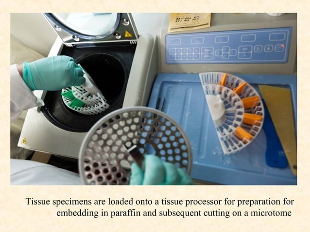 Tissue Processing in Histopathology | PPT