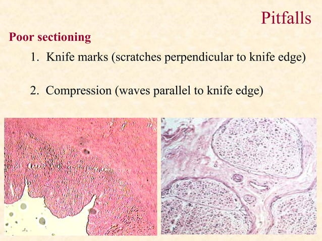 Tissue Processing in Histopathology | PPT