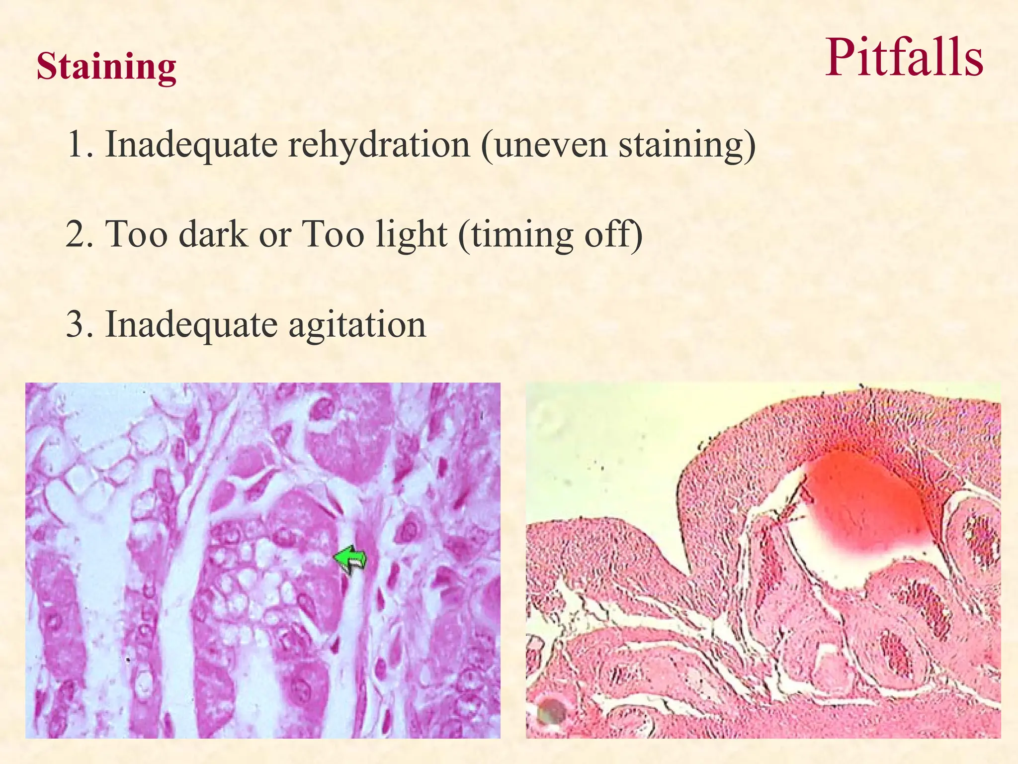 tissproc1-180324051812 (1).ppt Department of Patho | PPT