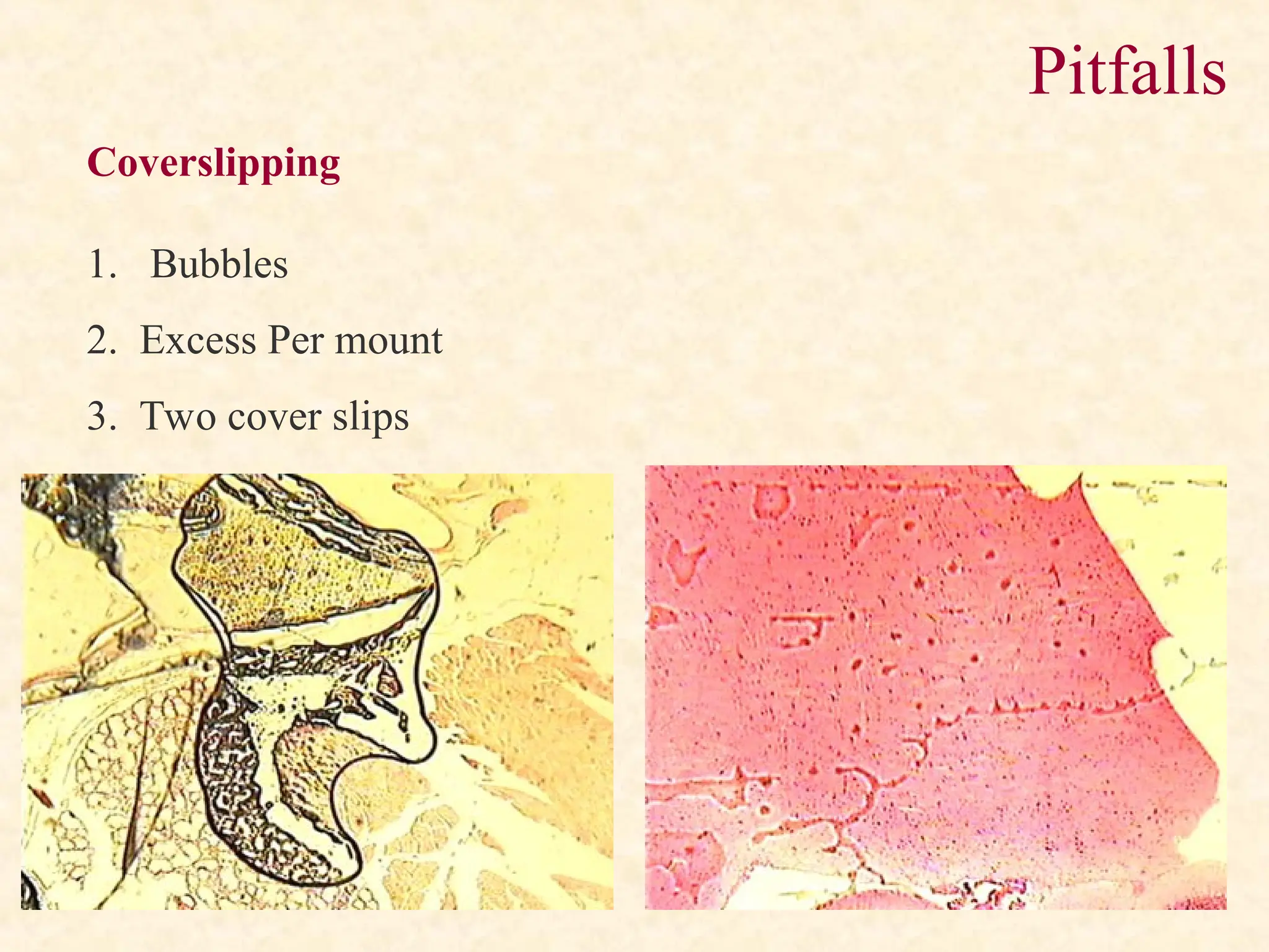 tissproc1-180324051812 (1).ppt Department of Patho | PPT