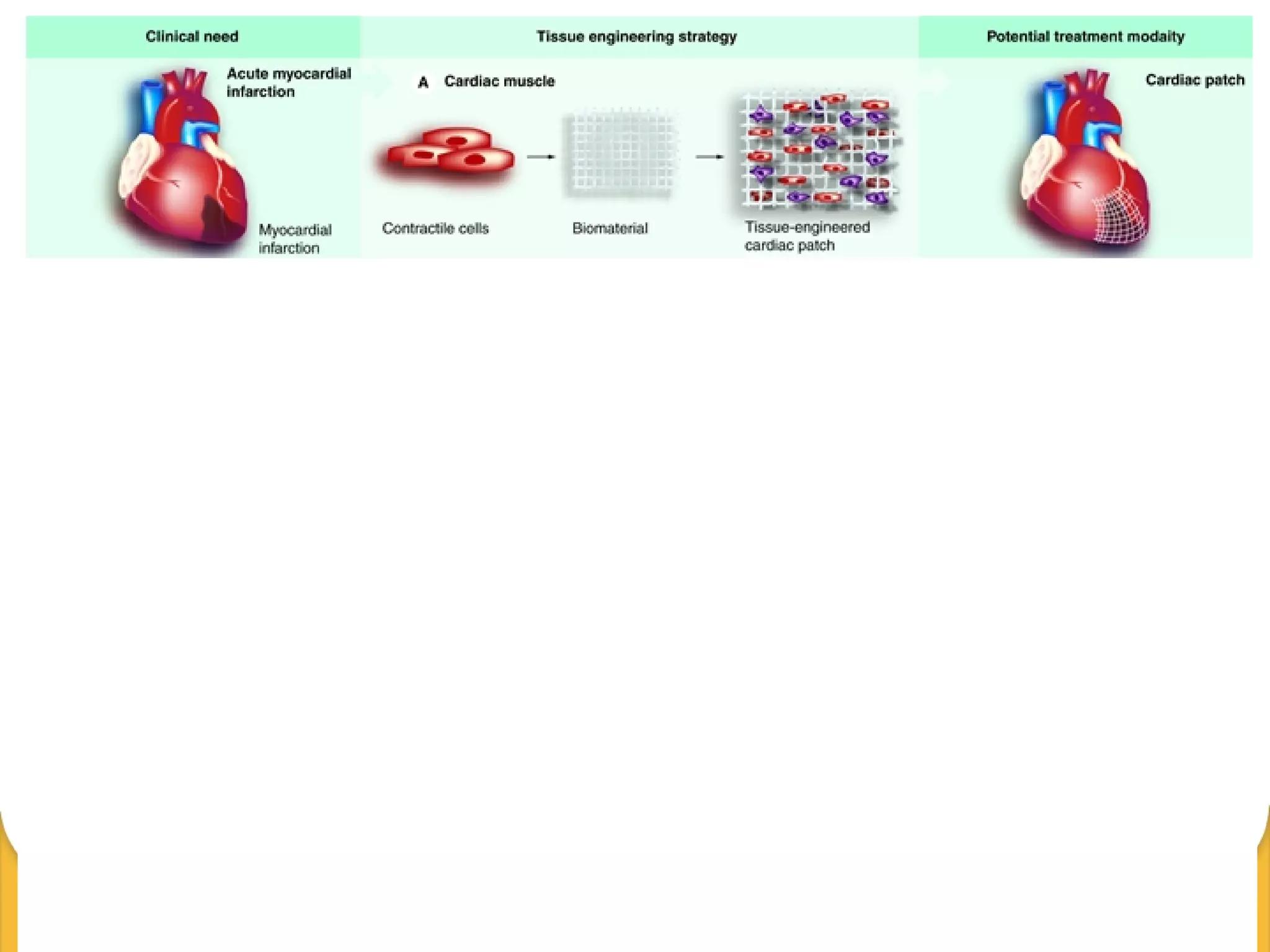 Tissue engineering in heart and valve failure management. | PDF