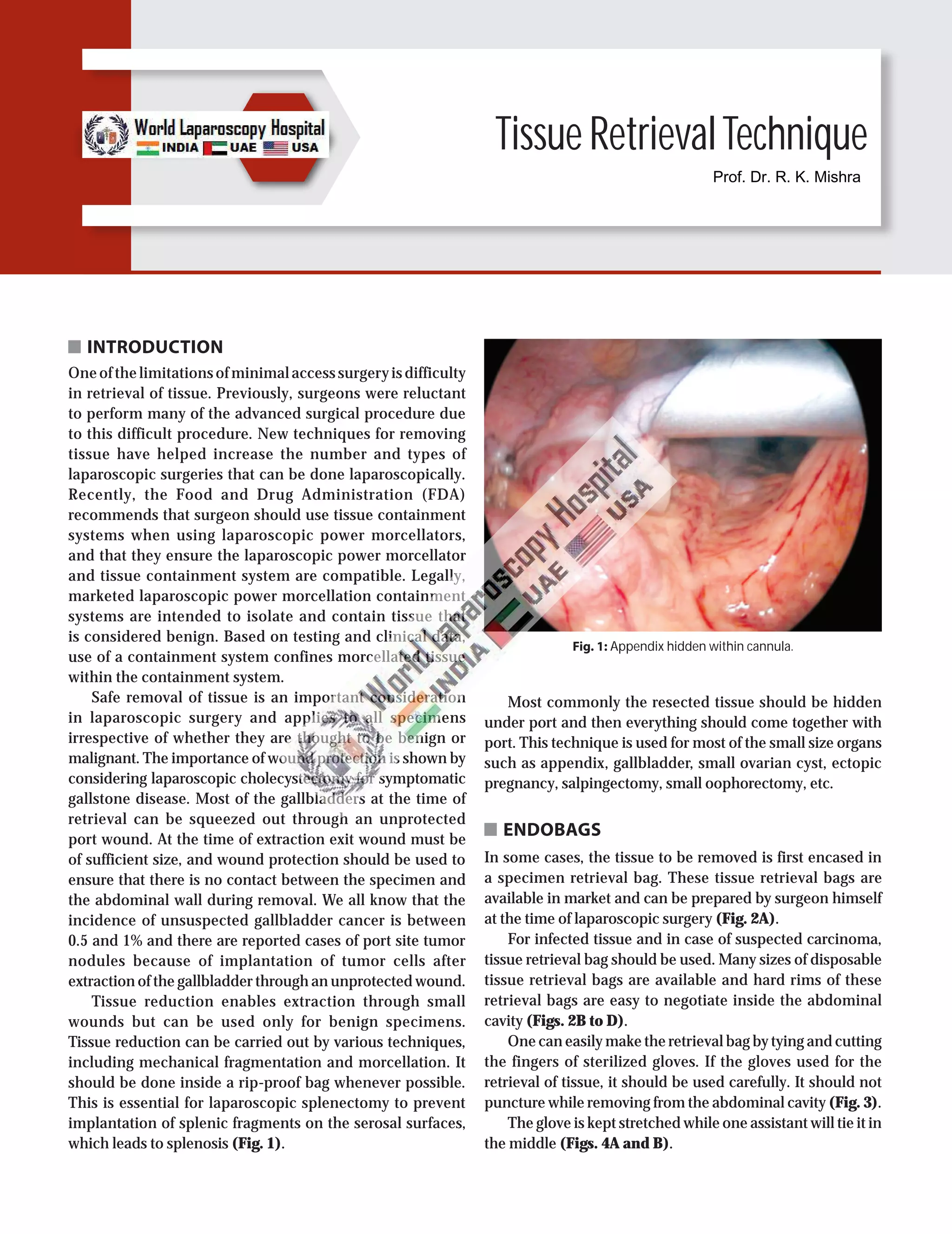 Tissue Retrieval Technique | PDF