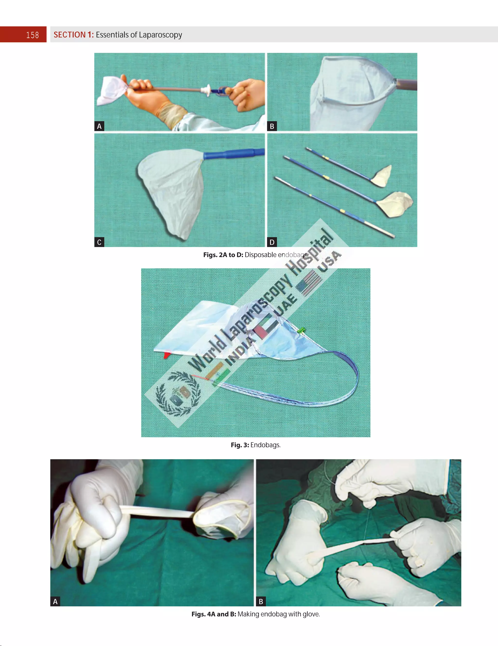 Tissue Retrieval Technique | PDF